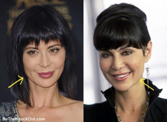 Catherine Bell Plastic Surgery Comparison Photos