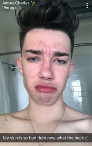 10 Stunning James Charles Without Makeup Photos