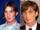 Cillian Murphy Plastic Surgery Comparison Photos