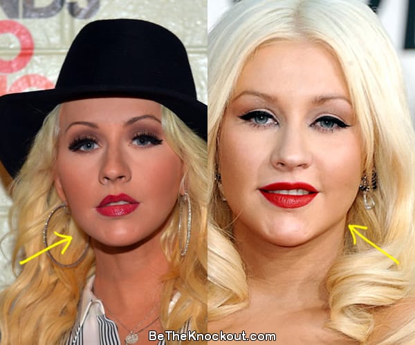 Christina Aguilera Plastic Surgery Comparison Photos